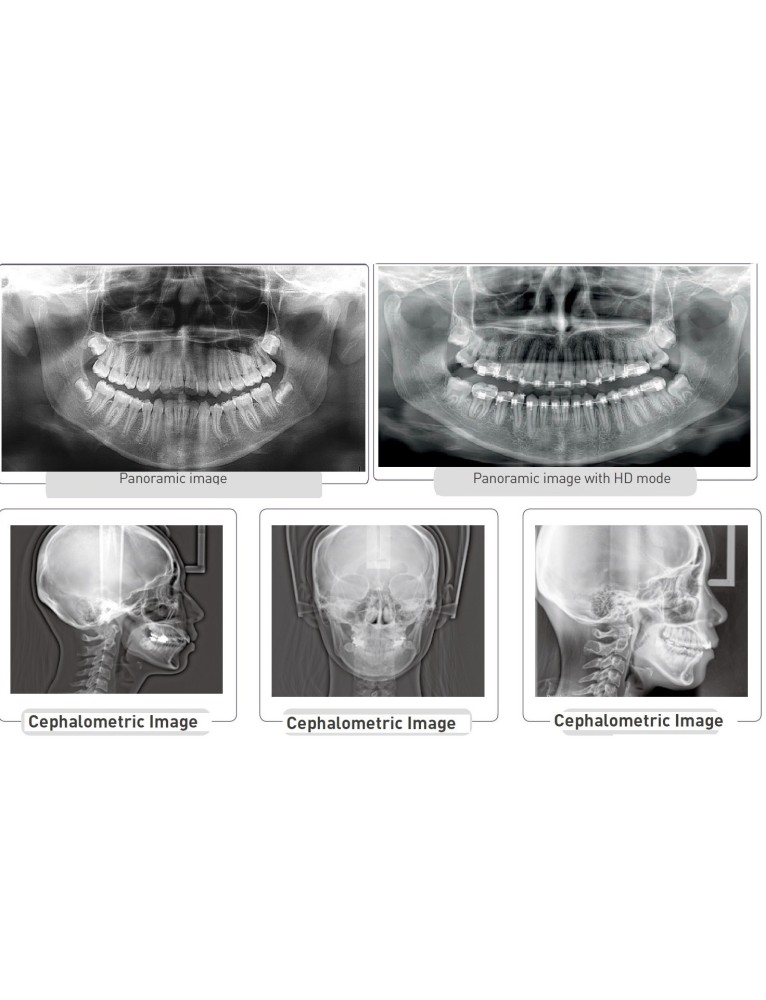 POINT 800S HD 3D PLUS PANORAMİK RÖNTGEN CİHAZI